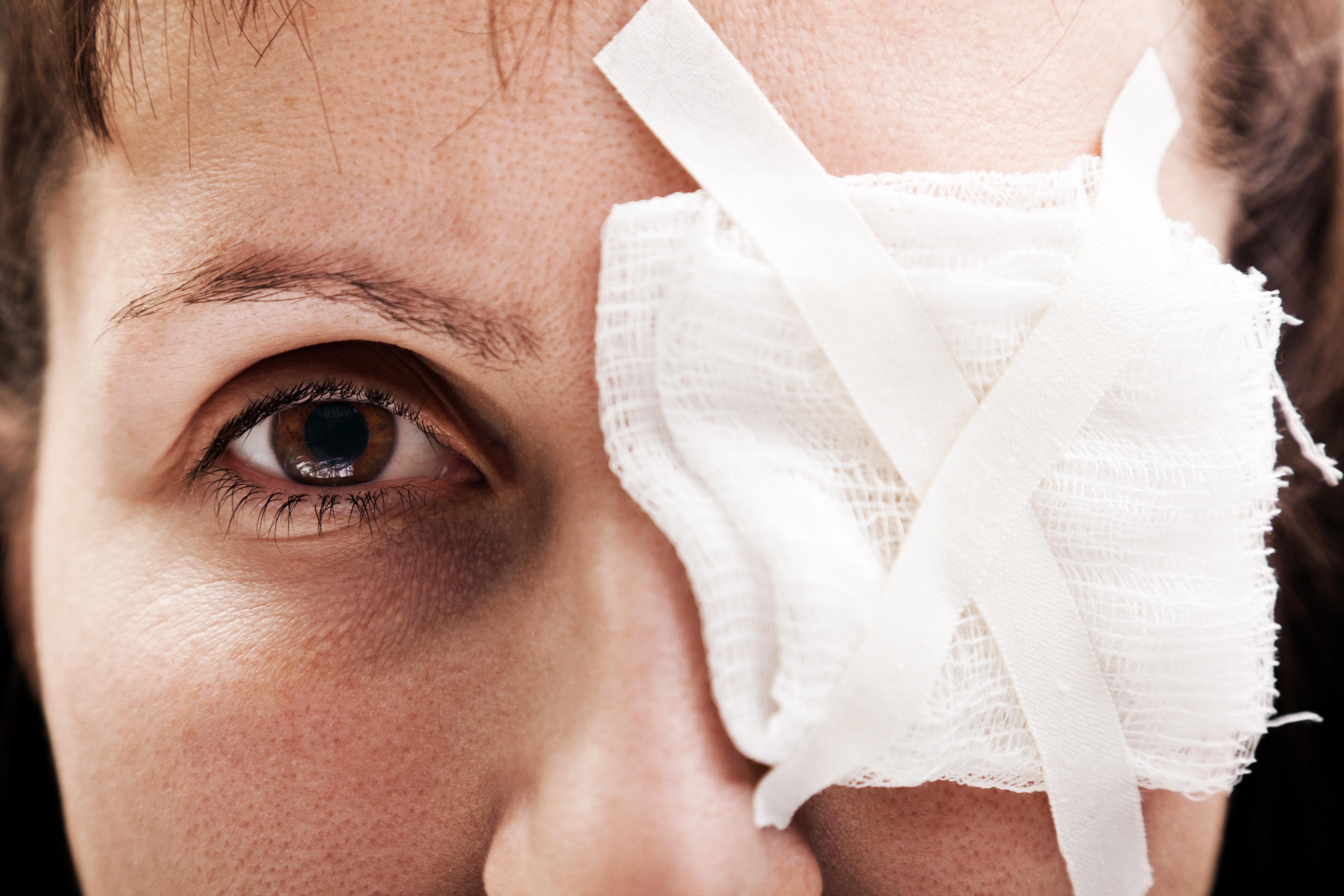 Eye Injury First Aid Tips | St John Vic
